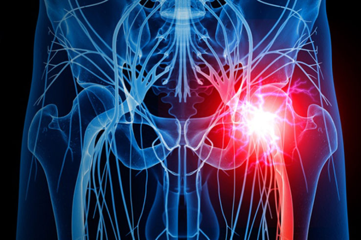 Afecțiunile Șoldului - Dr. Gican - Chirurgie Ortopedica